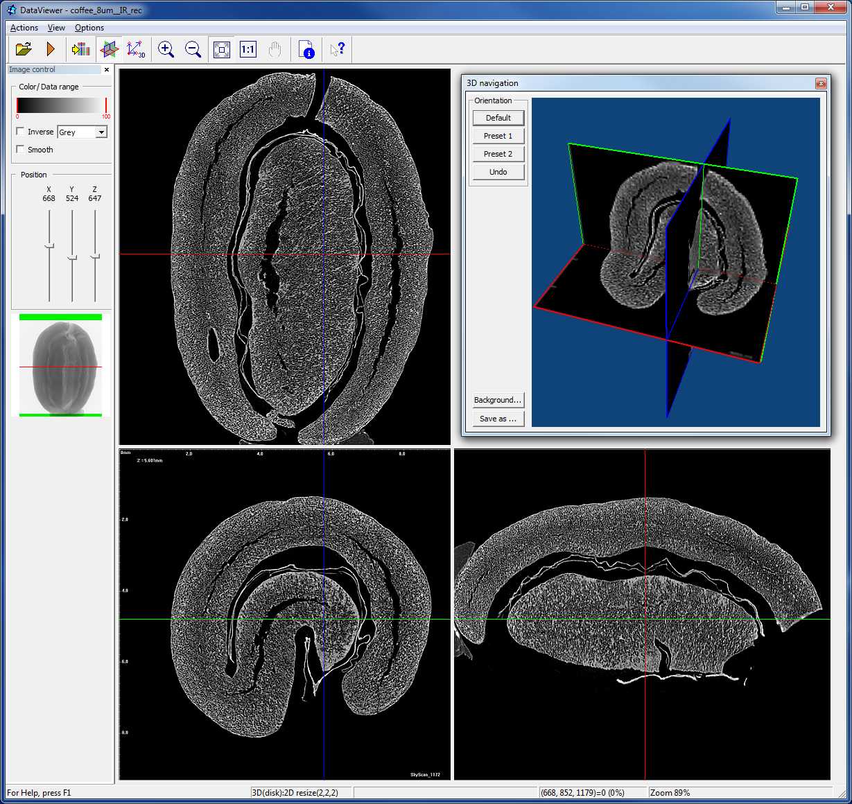 xiRAY Camera Choosen for World's First 11 MPix Micro-CT Scanner | XIMEA.com